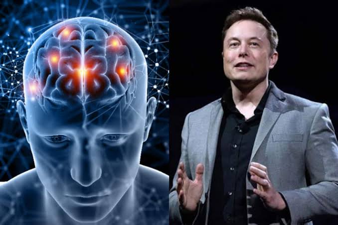 Elon Musk anuncia o implante de chip no cérebro em um ser humano pela ...